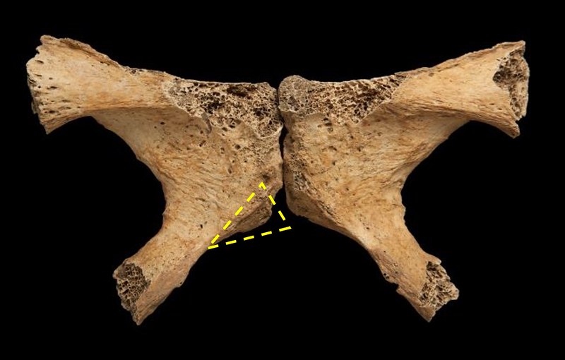 Ventral Arc Pelvis